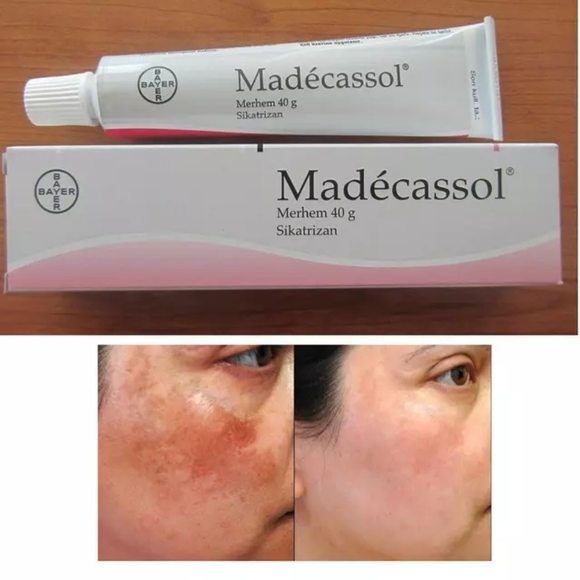 Madecassol | Other | Madecassol Skin Wound Burn Cream | Poshmark
